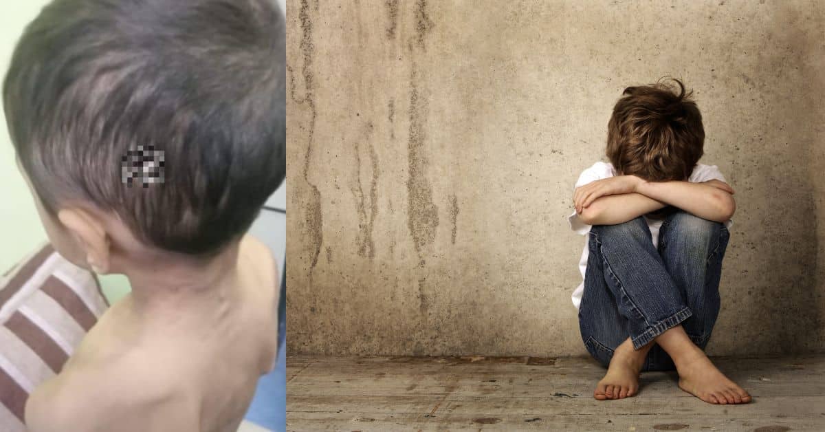 Lagi Kes Dera, Budak 6 Tahun Lari Rumah Tak Tahan Dipukul Bapa Kandung Dan Ibu Tiri